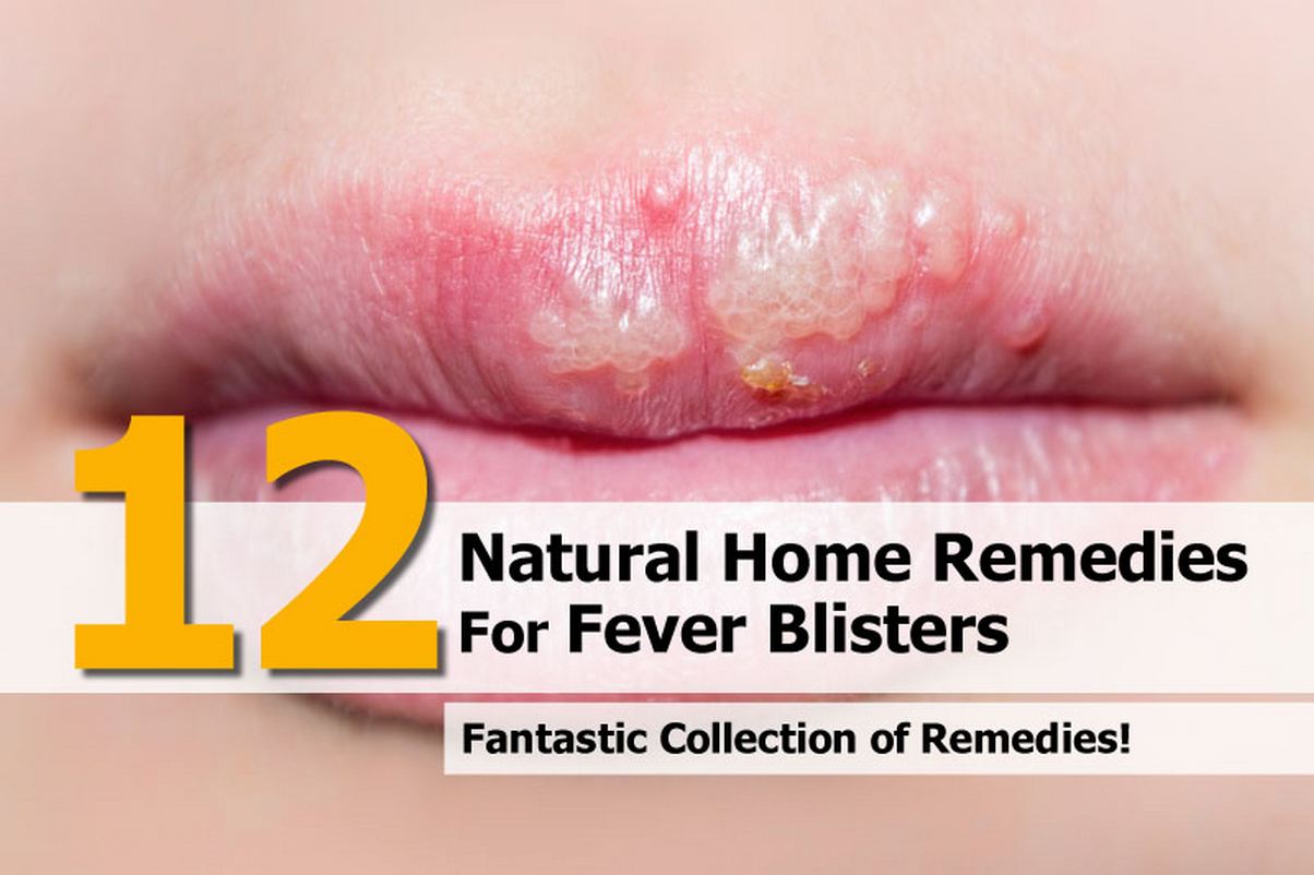 Fever Blister Fever Blister